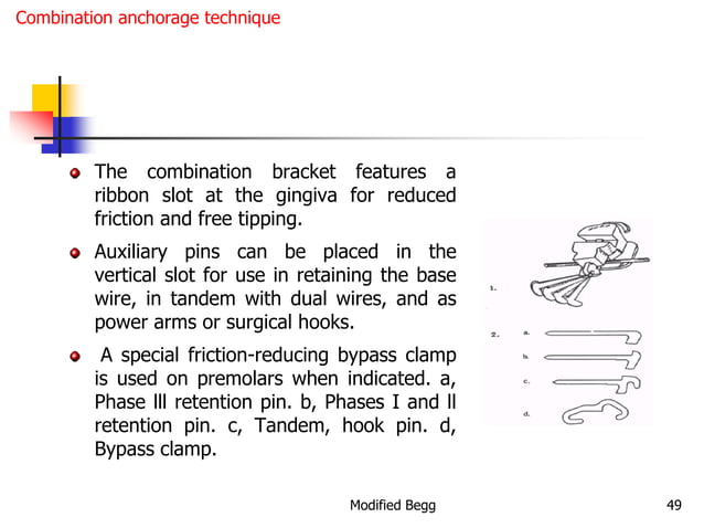 Modified begg orthodontics | PPT