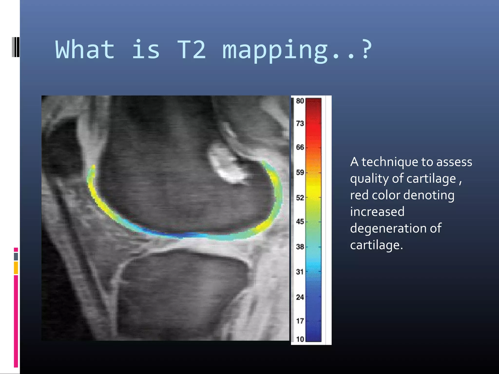 Cartilage imaging simplified | PPT
