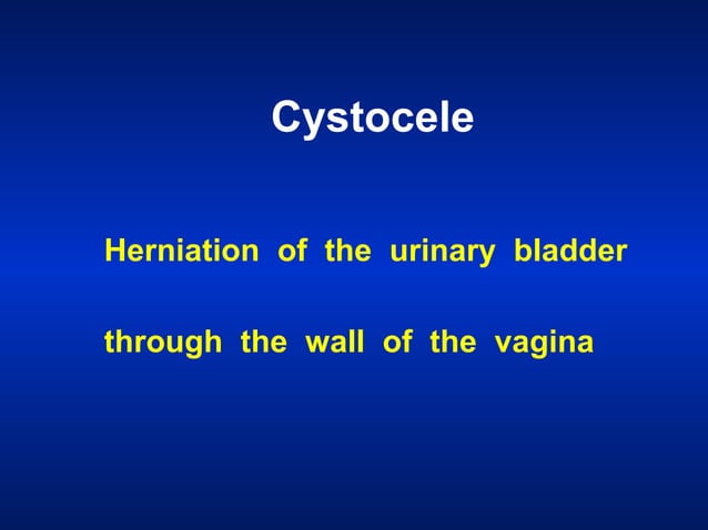 Modified extended anterior vaginal wall repair for cystocele | PPT