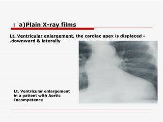 radiology.CVS 2 .(dr.abeer) | PPT