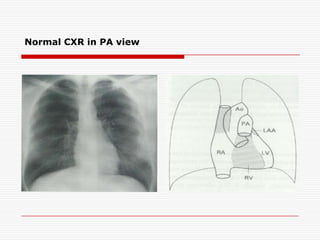 radiology.CVS 1st lecture.(dr.abeer) | PPTX