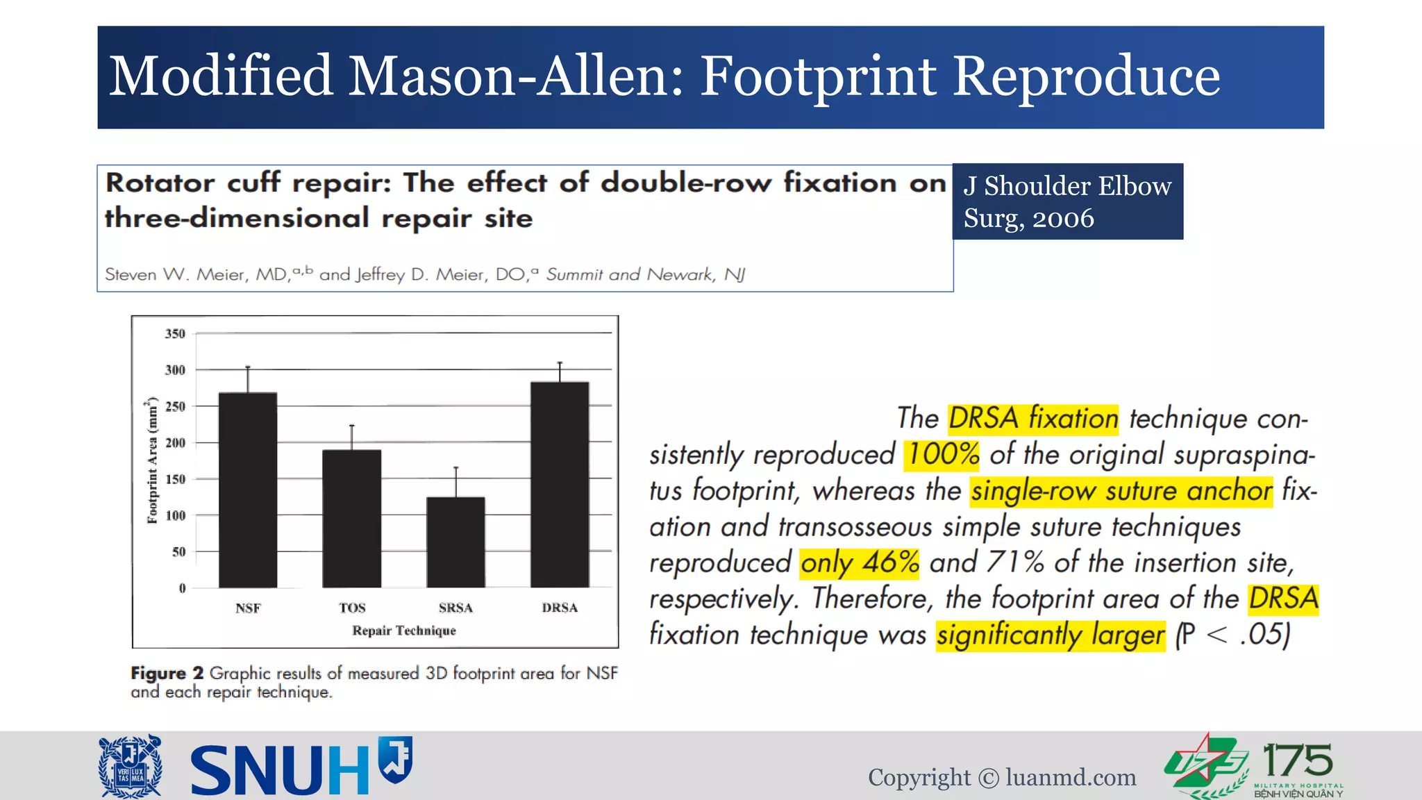Modified Mason-Allen Technique For Rotator Cuff Repair | PDF