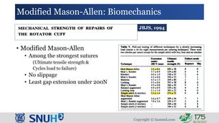 Modified Mason-Allen Technique For Rotator Cuff Repair | PDF