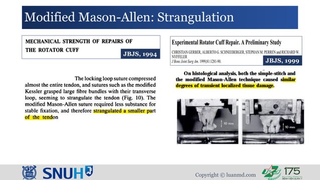 Modified Mason-Allen Technique For Rotator Cuff Repair | PDF | Death ...