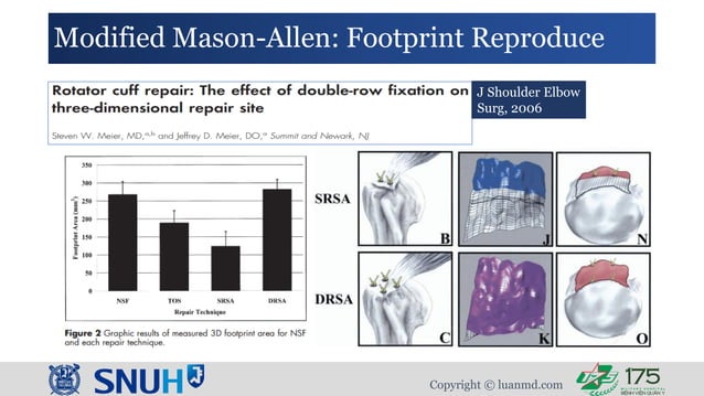 Modified Mason-Allen Technique For Rotator Cuff Repair | PDF | Death ...