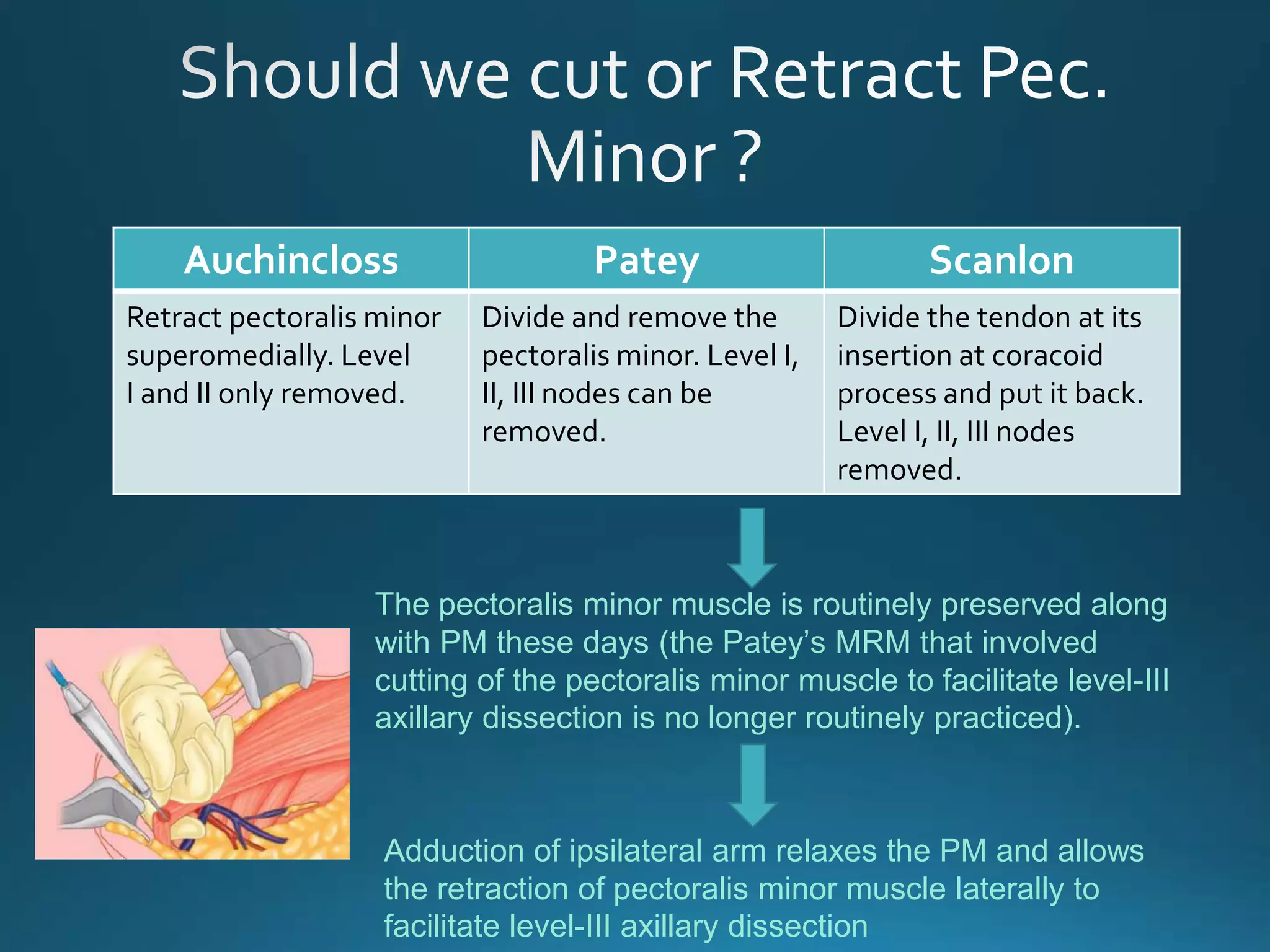 Modified radical mastectomy | PPTX