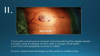 MODIFIED RADICAL MASTECTOMY-OPERATIVE PROCEDURE.pptx