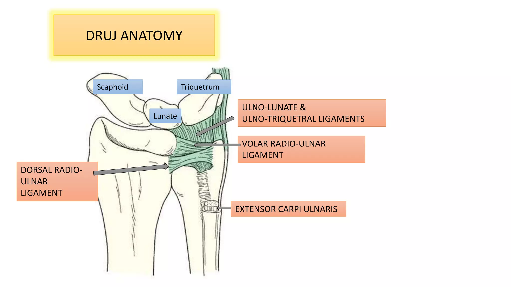 Modified sauve kapandji procedure for patients with old fractures | PPTX