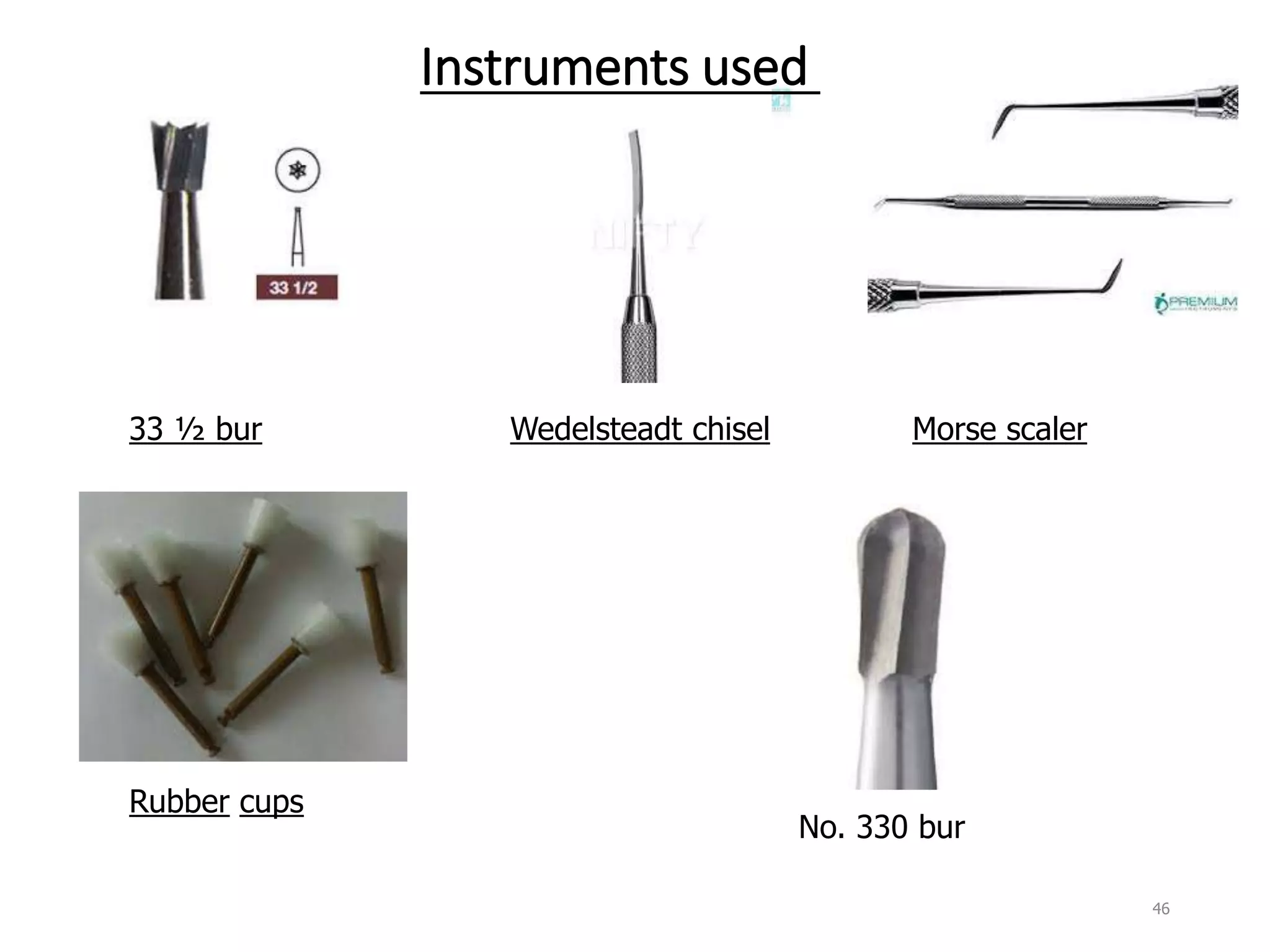 direct filling-gold seminar | PPTX