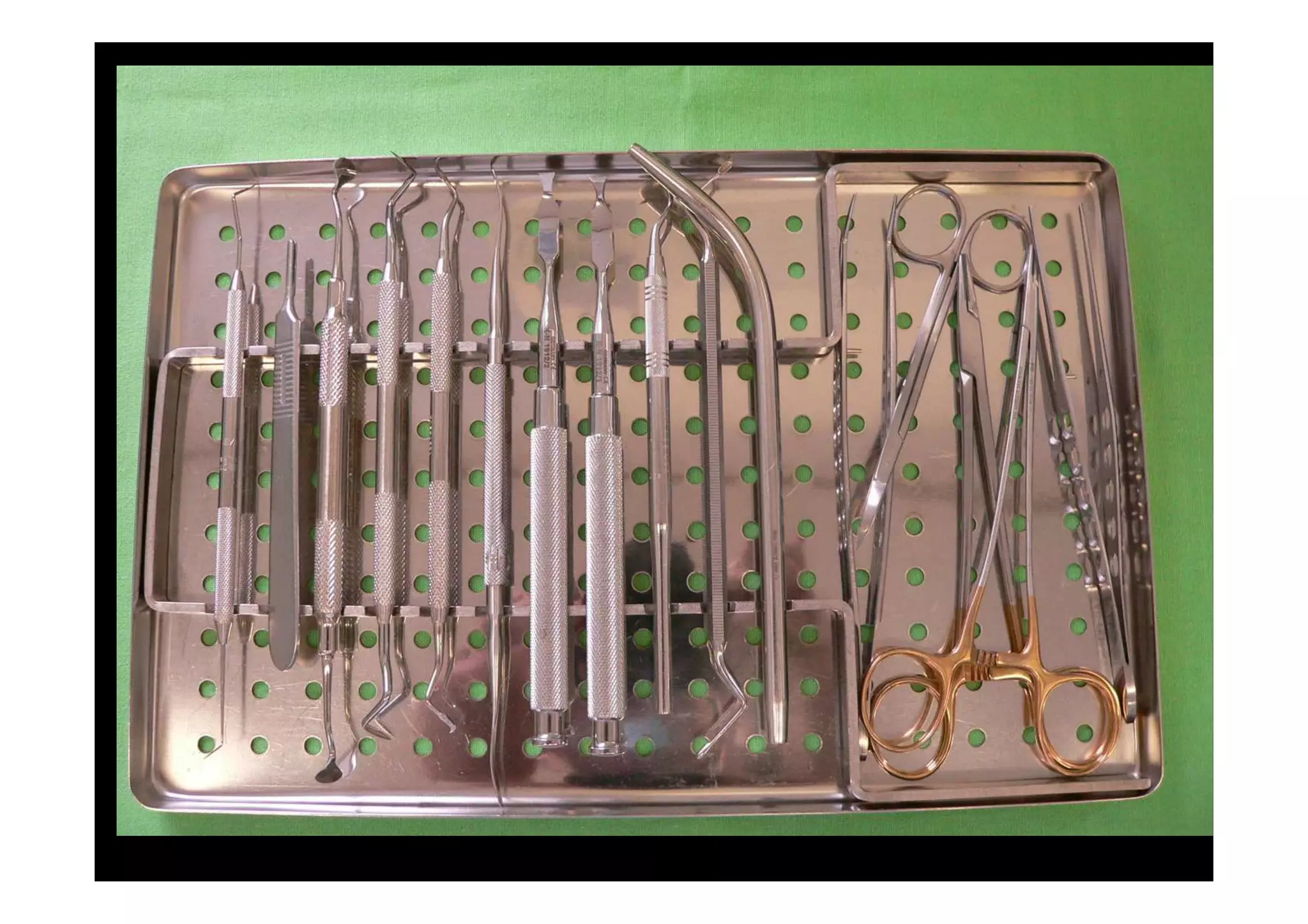 Modified widman flap | PDF