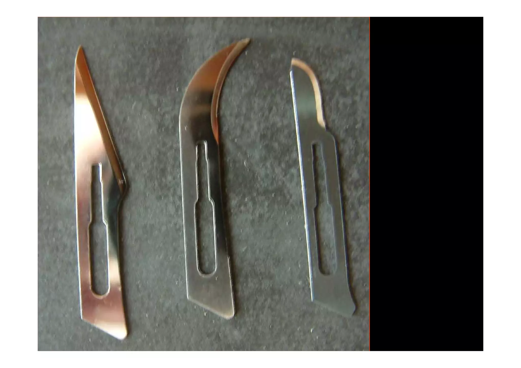 Modified widman flap | PDF