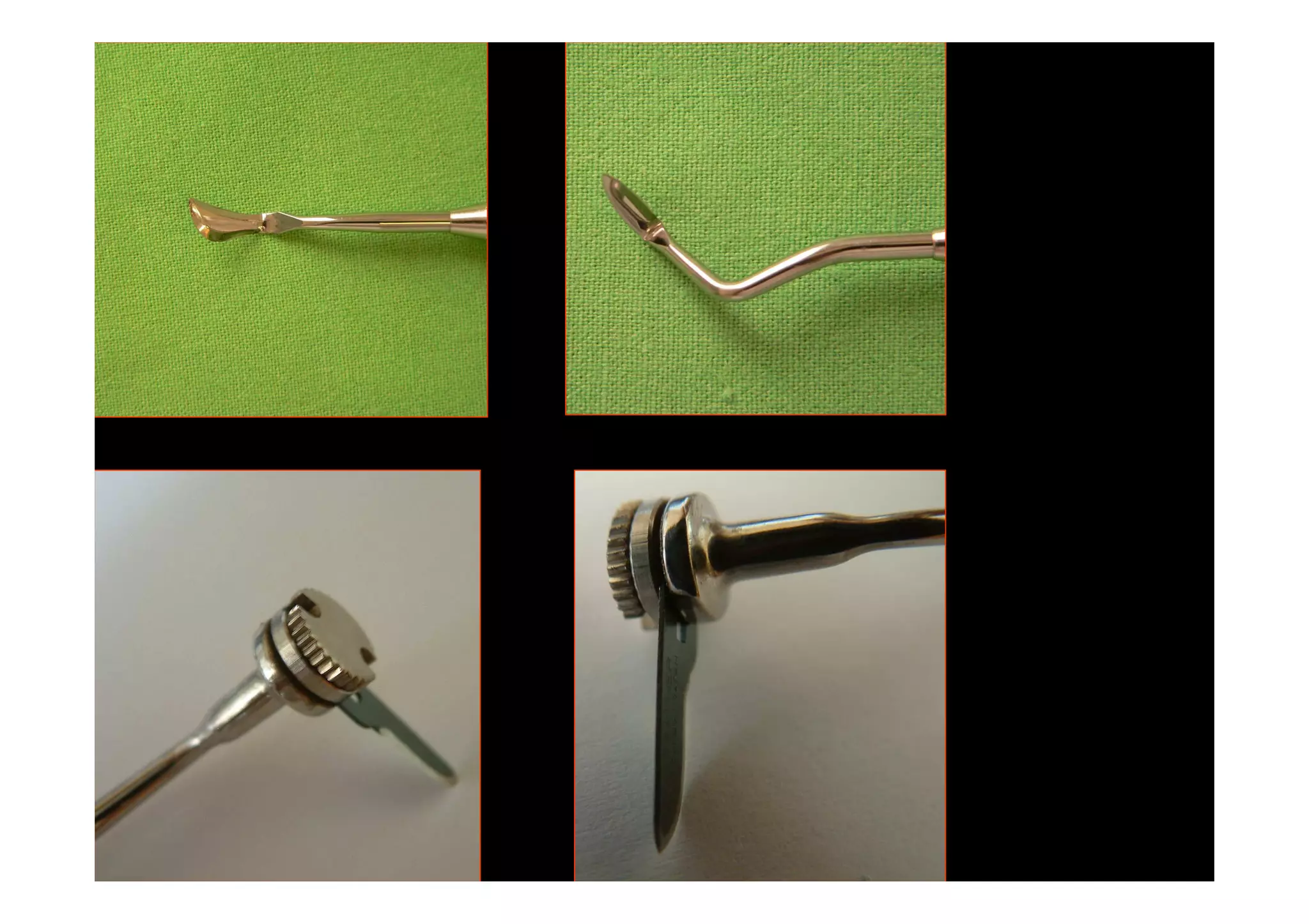 Modified widman flap | PDF