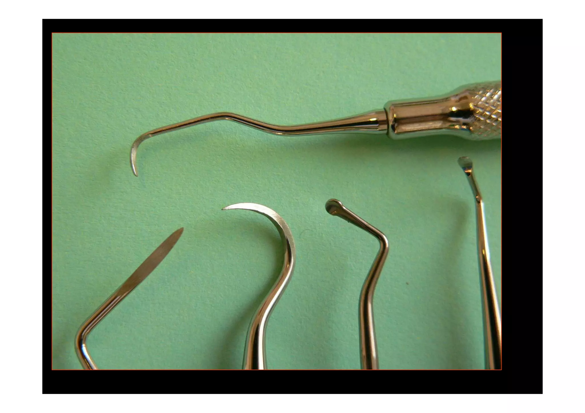 Modified widman flap | PDF