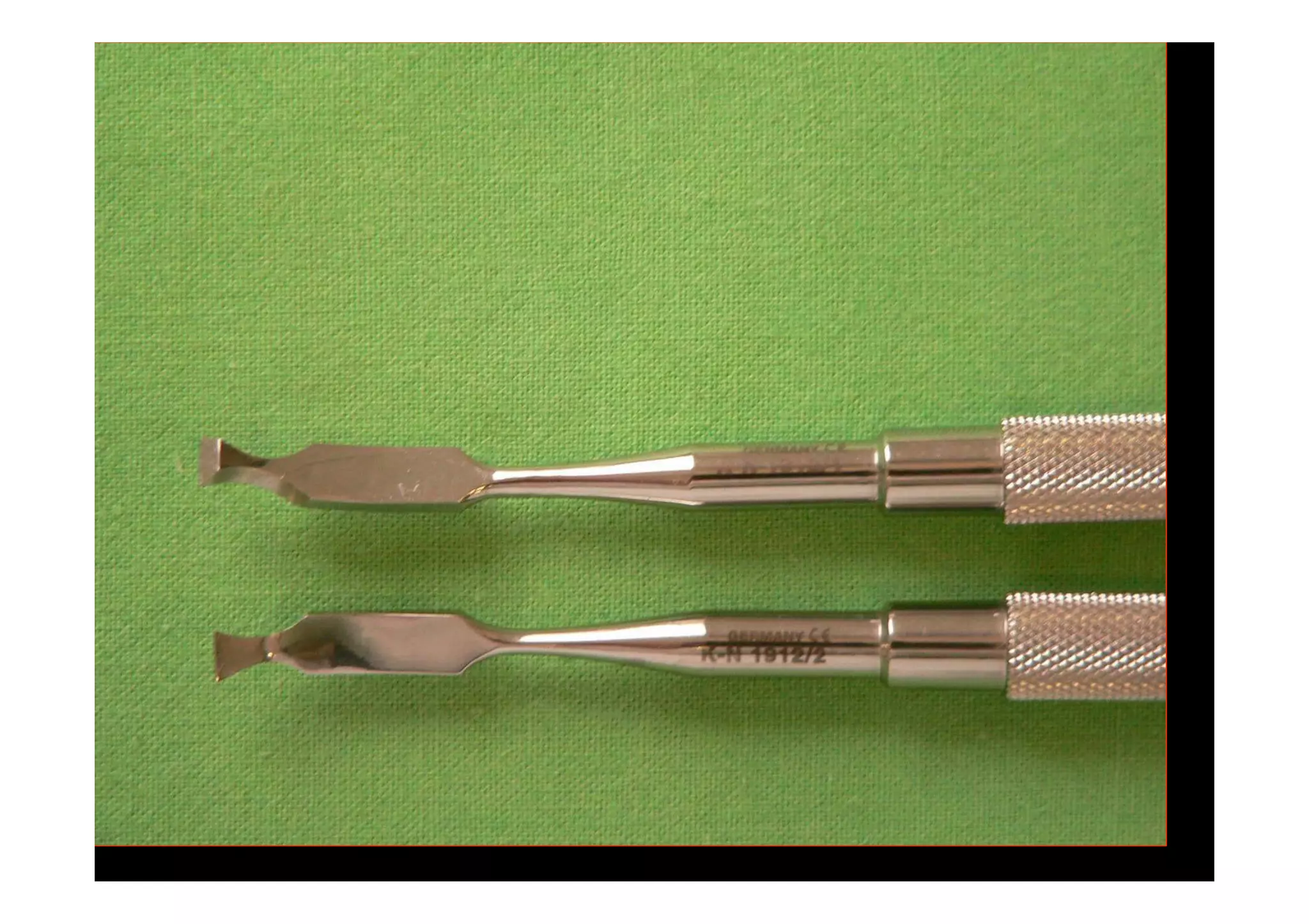 Modified widman flap | PDF