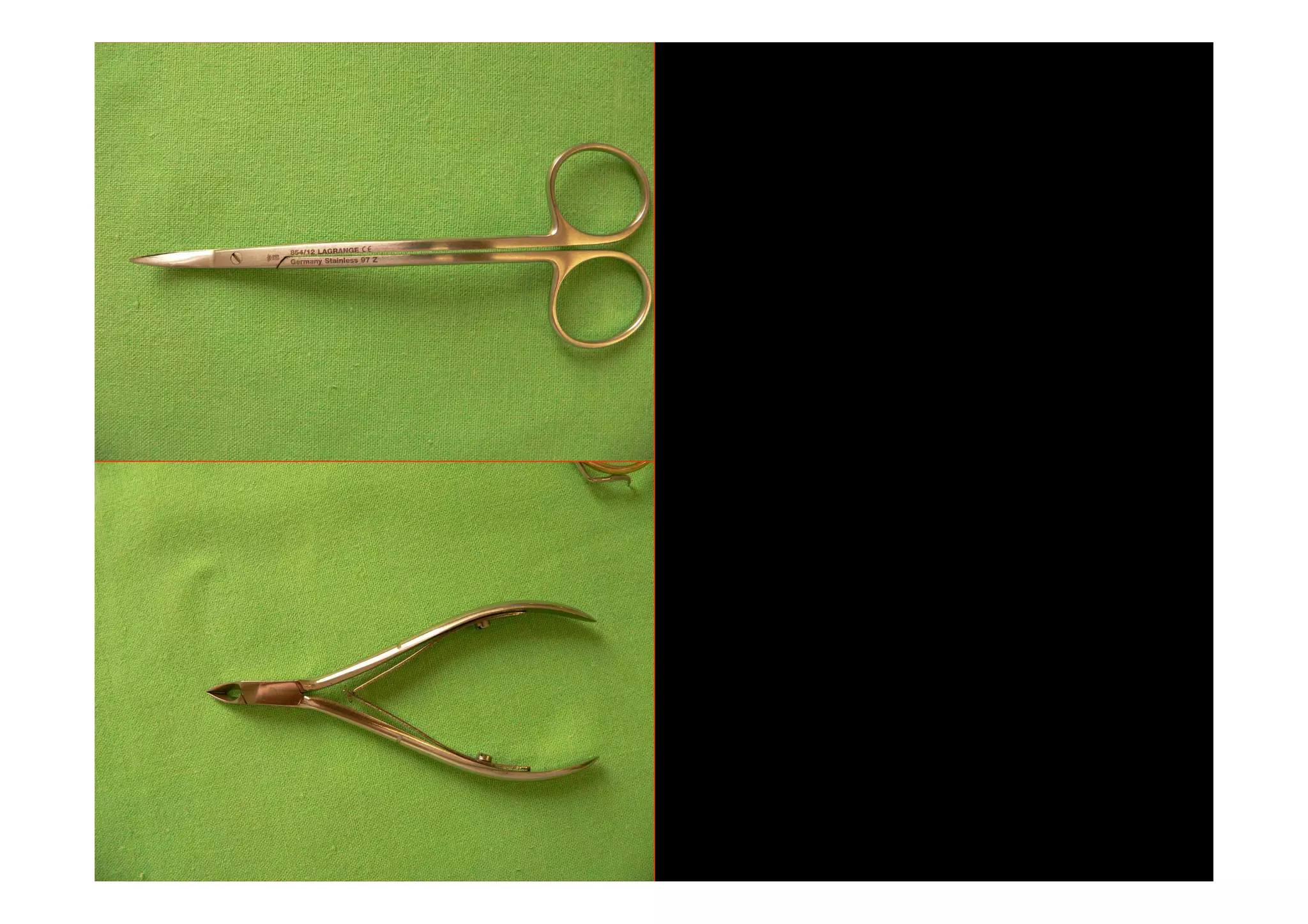 Modified widman flap | PDF