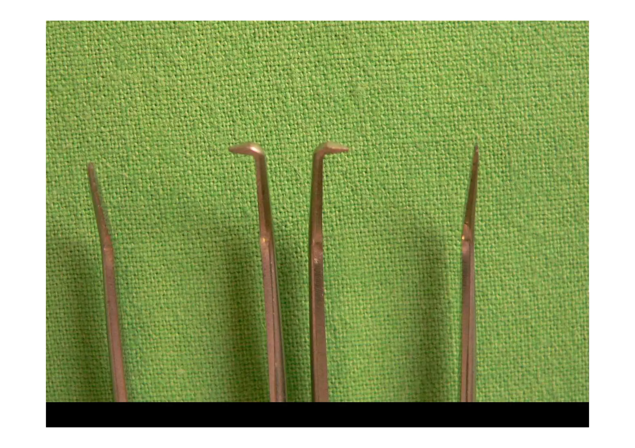 Modified widman flap | PDF