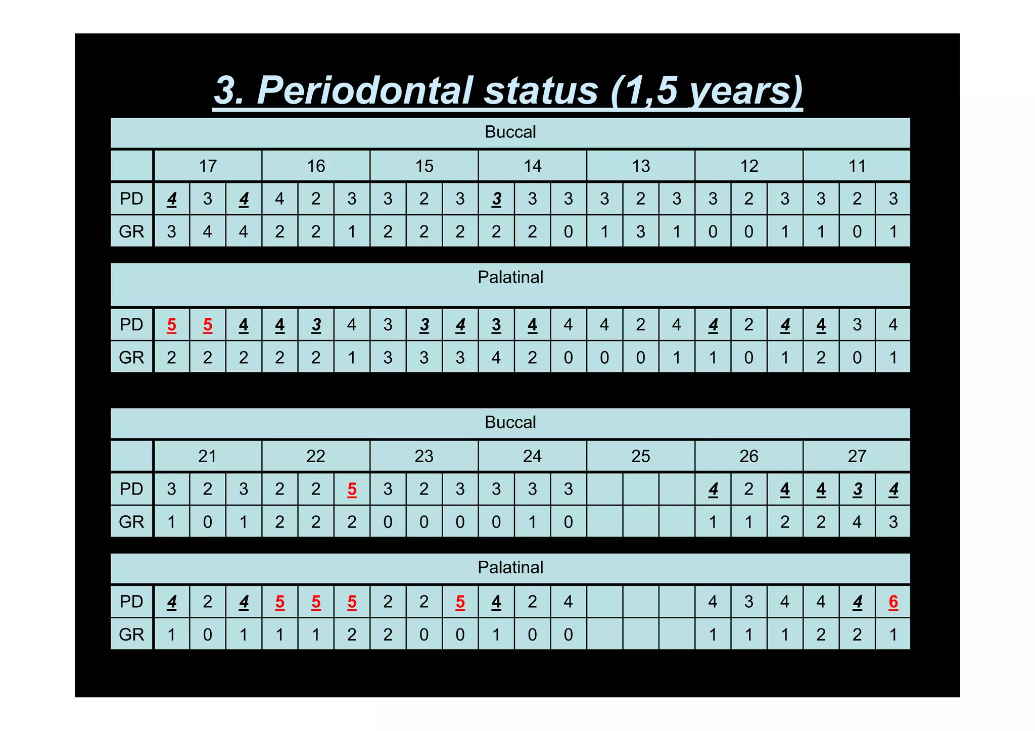 Modified widman flap | PDF