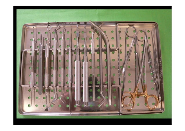 Modified widman flap | PDF