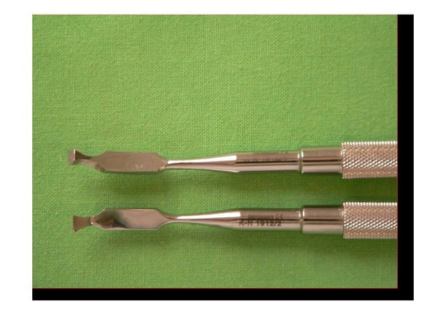 Modified widman flap | PDF