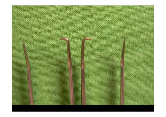 Modified widman flap | PDF