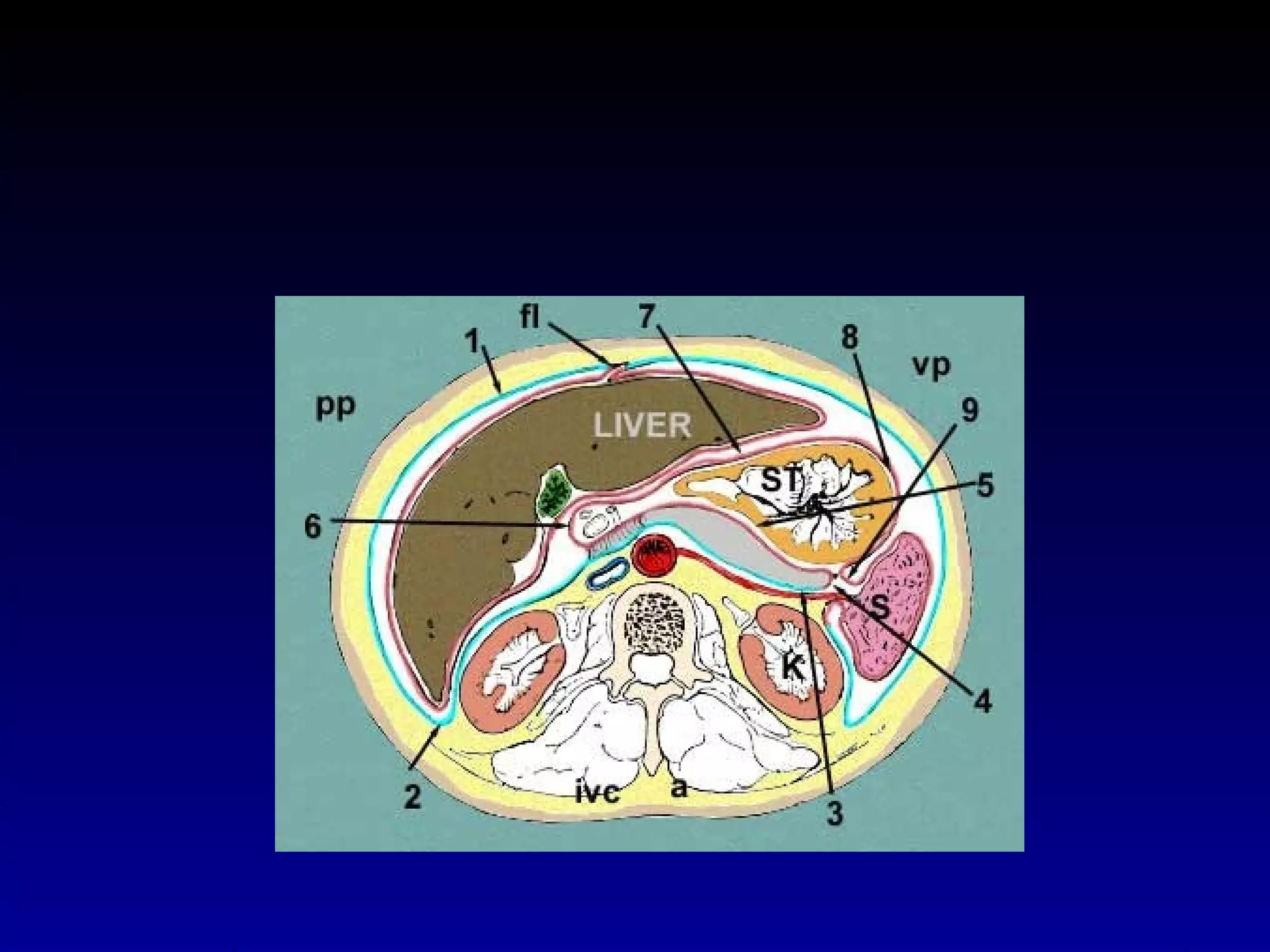 Modlin kidney transplant techniques presentation | PPT