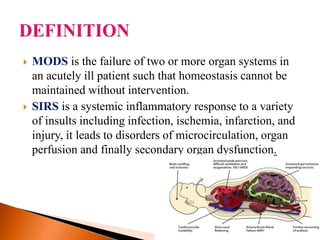 MULTIPLE ORGAN DYSFUNCTION SYNDROME | PPT | Free Download