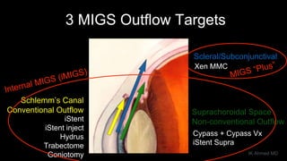 SPOTLIGHT ON MIGS | PPTX