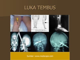 Modul 11 mekanisme cedera sinkronisasi modu lppt | PPT