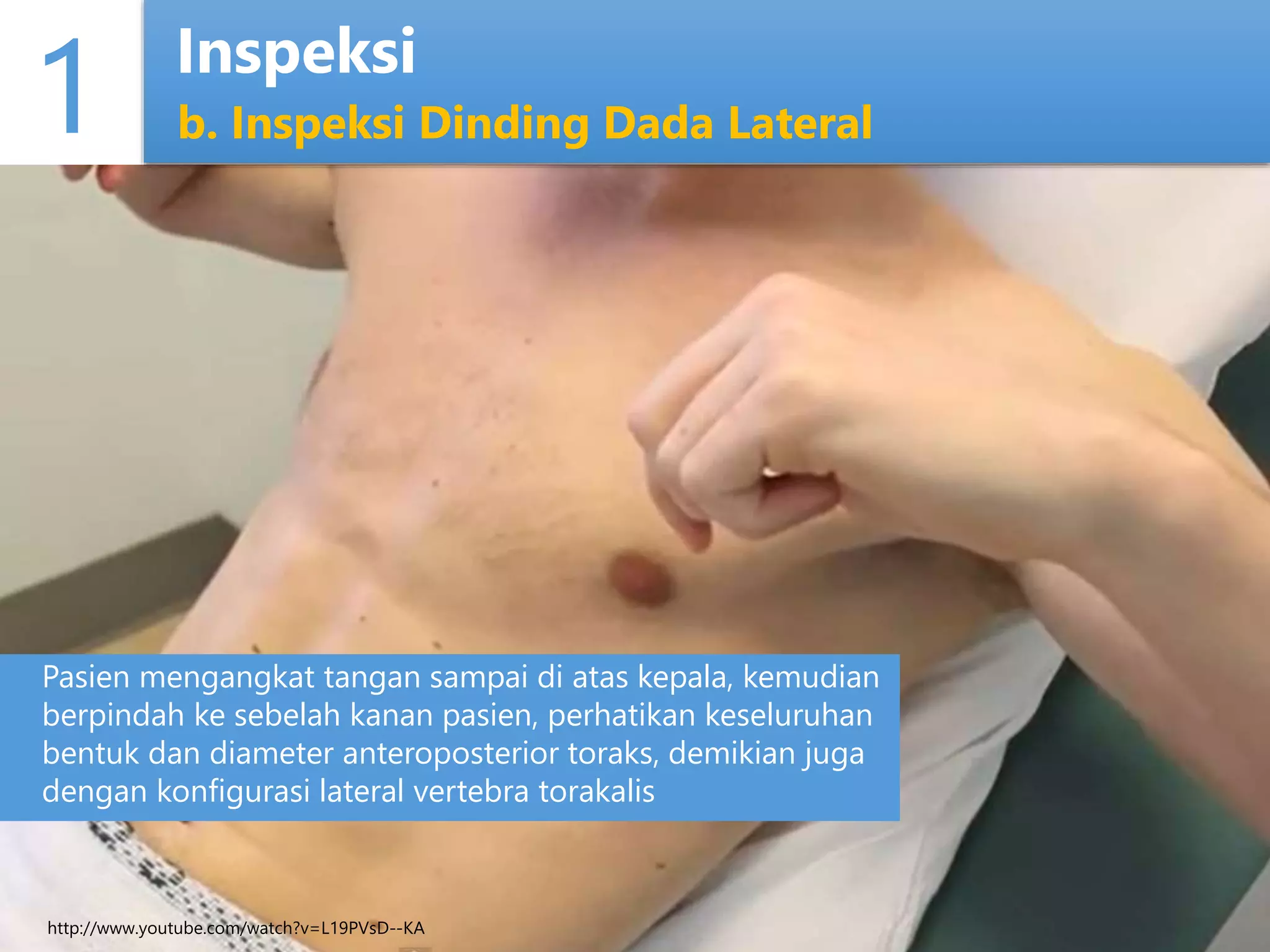 Modul 1 kb1 pemeriksaan fisik sistem pernafasan | PPTX