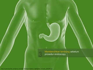 Modul 3 kb2 kumbah lambung | PPTX