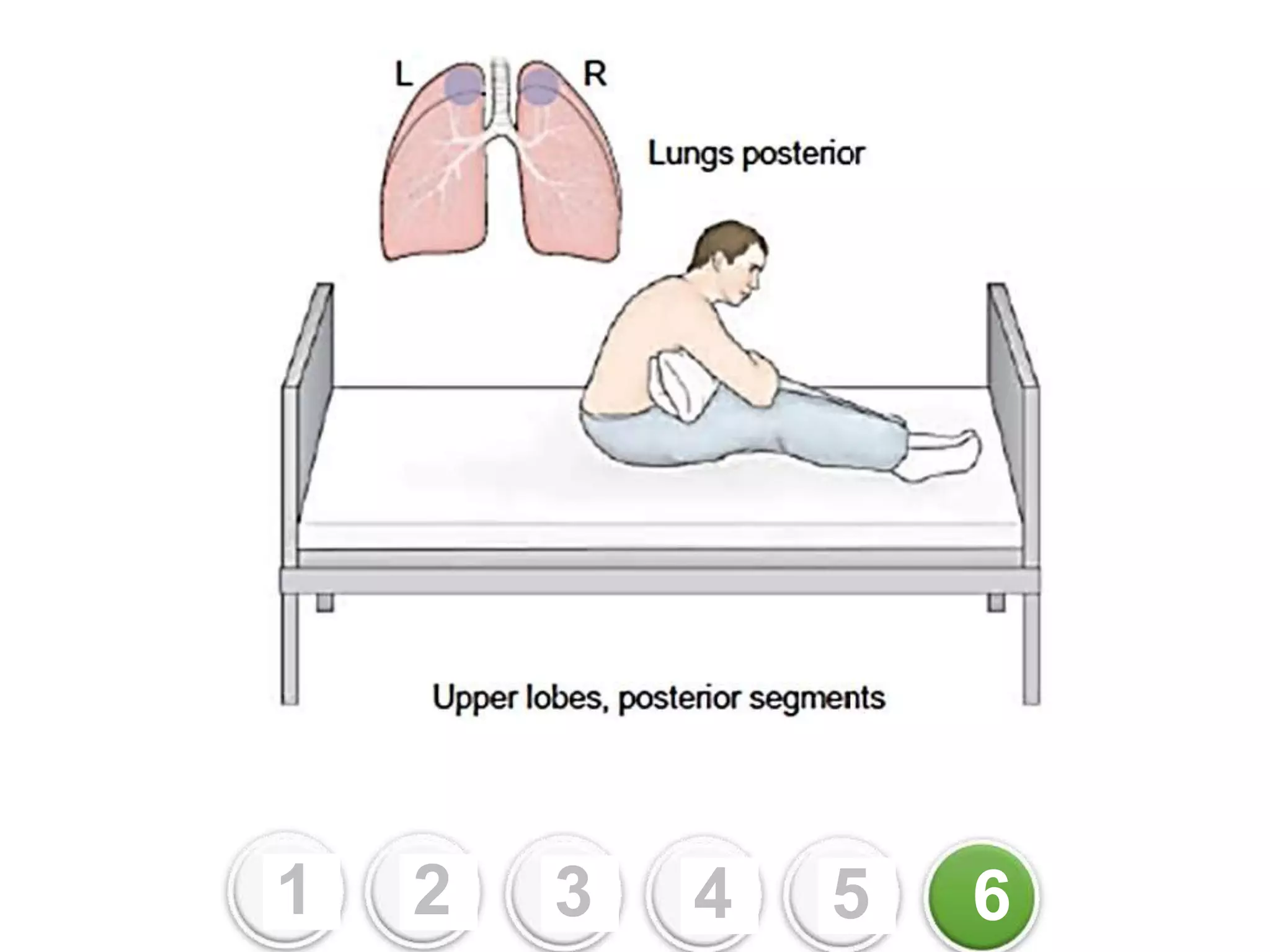 Modul 1 kb2 postural drainage | PPTX