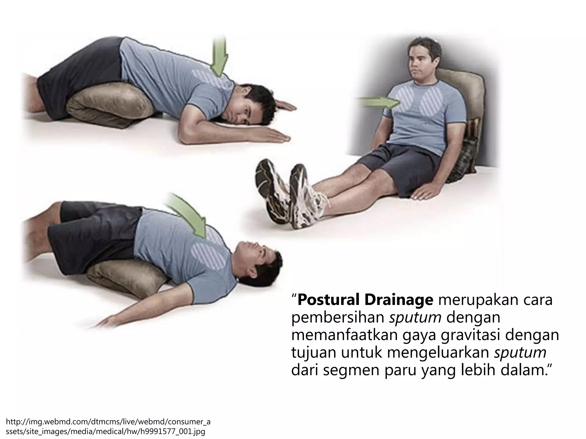 Modul 1 kb2 postural drainage | PPTX