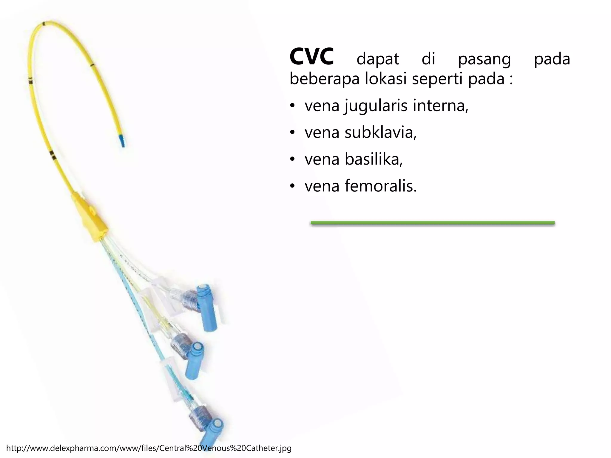 Modul 1 kb3 pengukuran central venous pressure (cvp) | PPTX