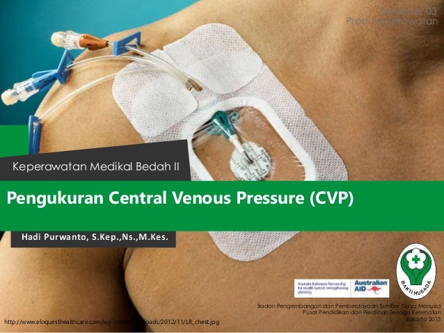 Modul 1 kb3 pengukuran central venous pressure (cvp)