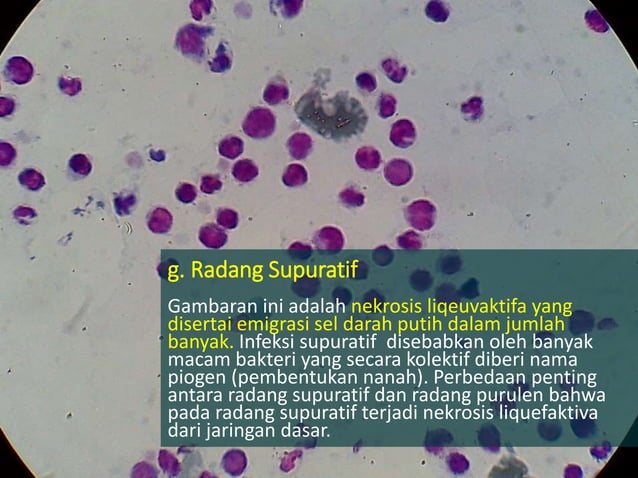 Radang dan mekanisme proses Infeksi | PPT