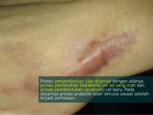 Modul 3 kb 2 proses penyembuhan luka