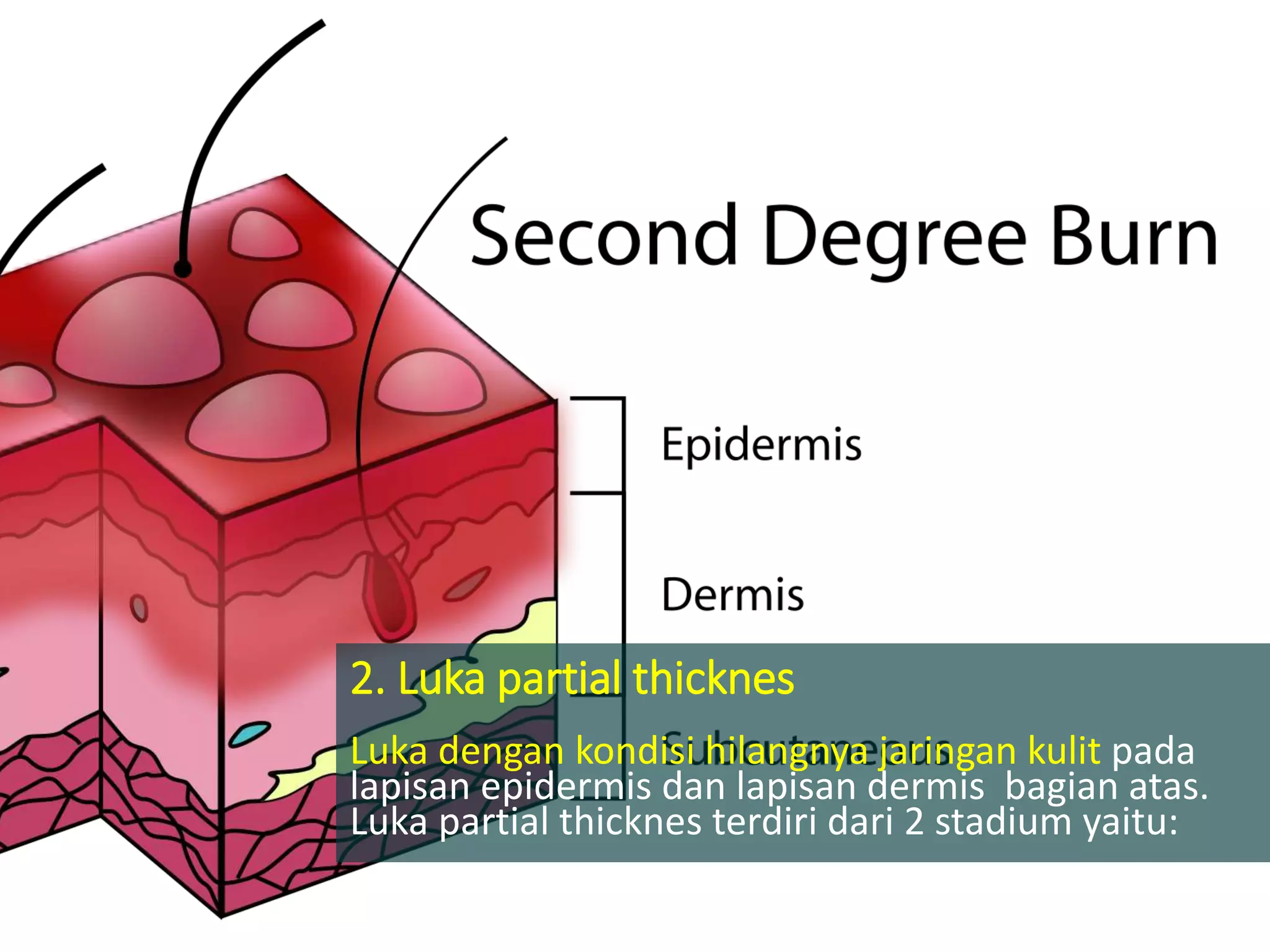 Proses Penyembuhan luka | PPTX