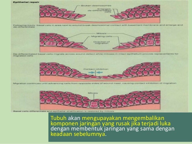 Proses Penyembuhan luka