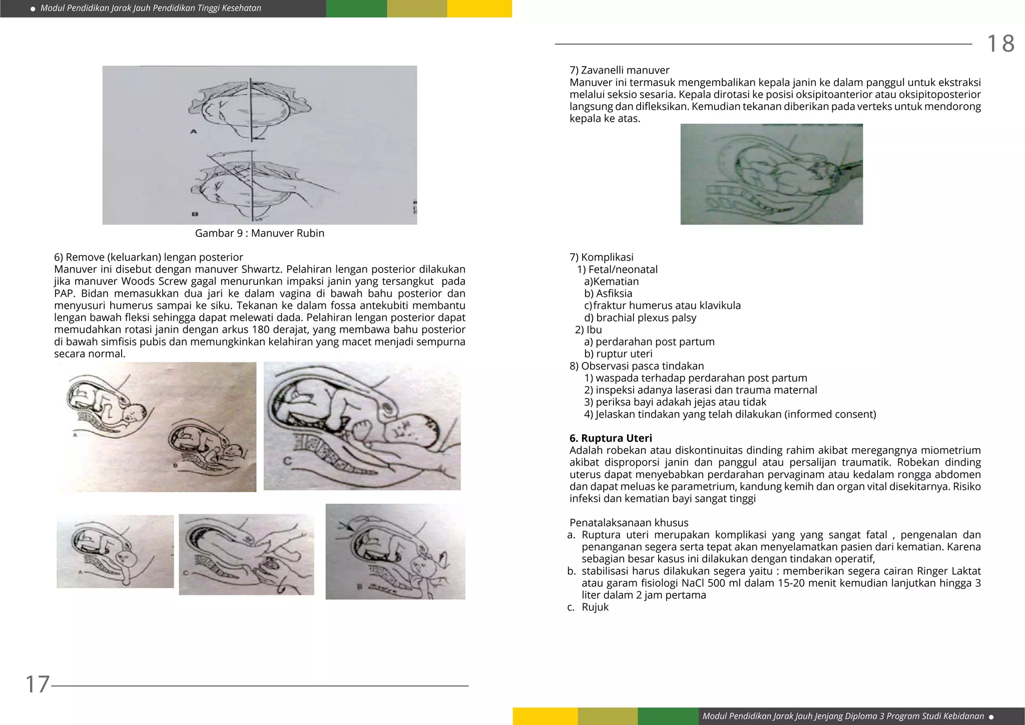 KB 2 Kedaruratan Obstetri pada Persalinan dan Penatalaksanaannya | PDF