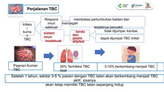 Modul 4B Diagnosis TBC pada Dewasa OK.pptx