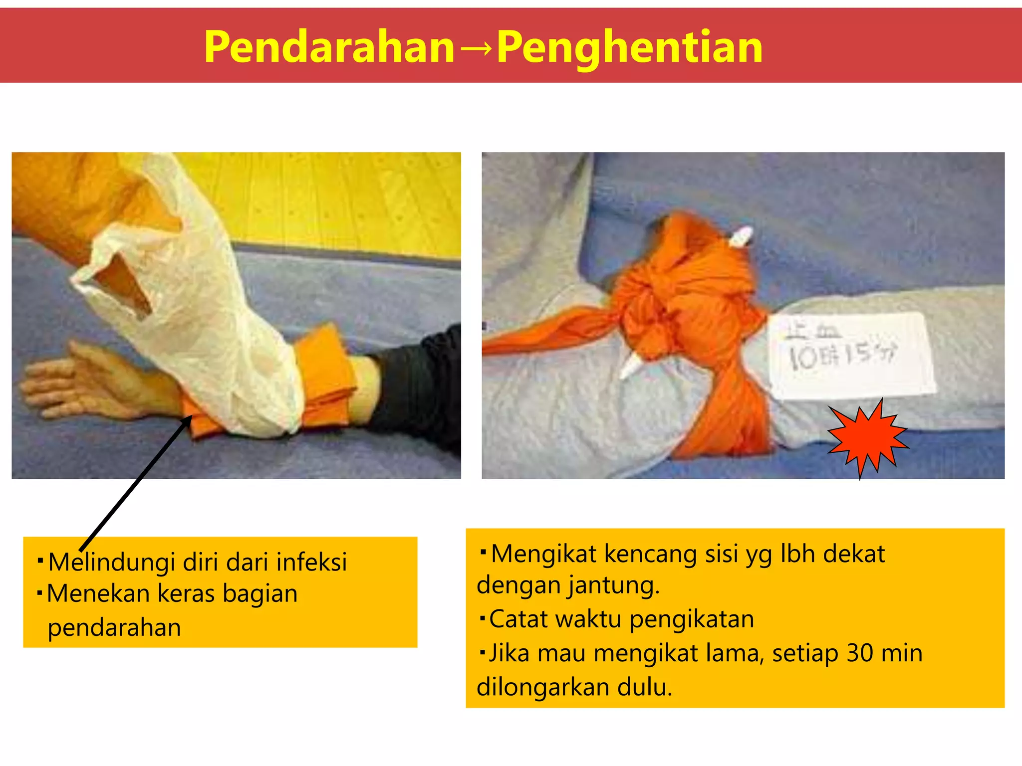 Modul 4 kb 1 3 t bencana (triase treatment-transportation) | PPTX