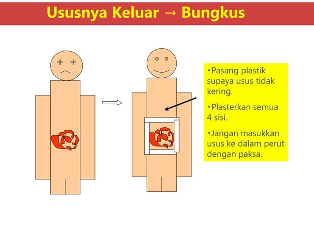 Modul 4 kb 1 3 t bencana (triase treatment-transportation) | PPTX