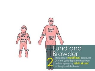 Modul 4 kb 1 penanganan luka bakar | PPT