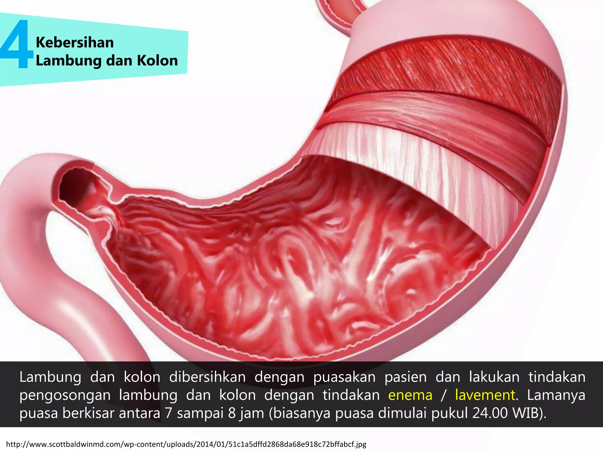Modul 5 kb1 persiapan pasien pre operatif | PPTX