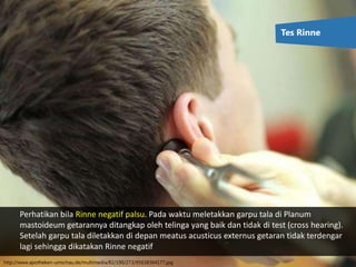 Modul 4 kb2 pemeriksaan fungsi pendengaran | PPTX