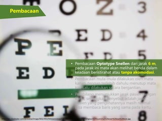 Modul 4 kb3 pemeriksaan fungsi penglihatan | PPTX