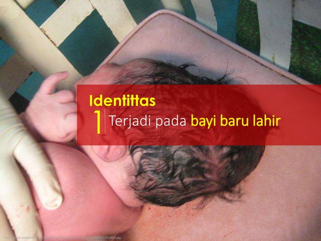 Modul 5 kb 1 asuhan neonatus dan bayi dengan caput succedaneum | PPTX