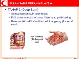 Terbakar & Melecur | PPS