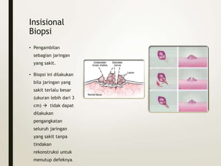 Modul Biopsi.pptx