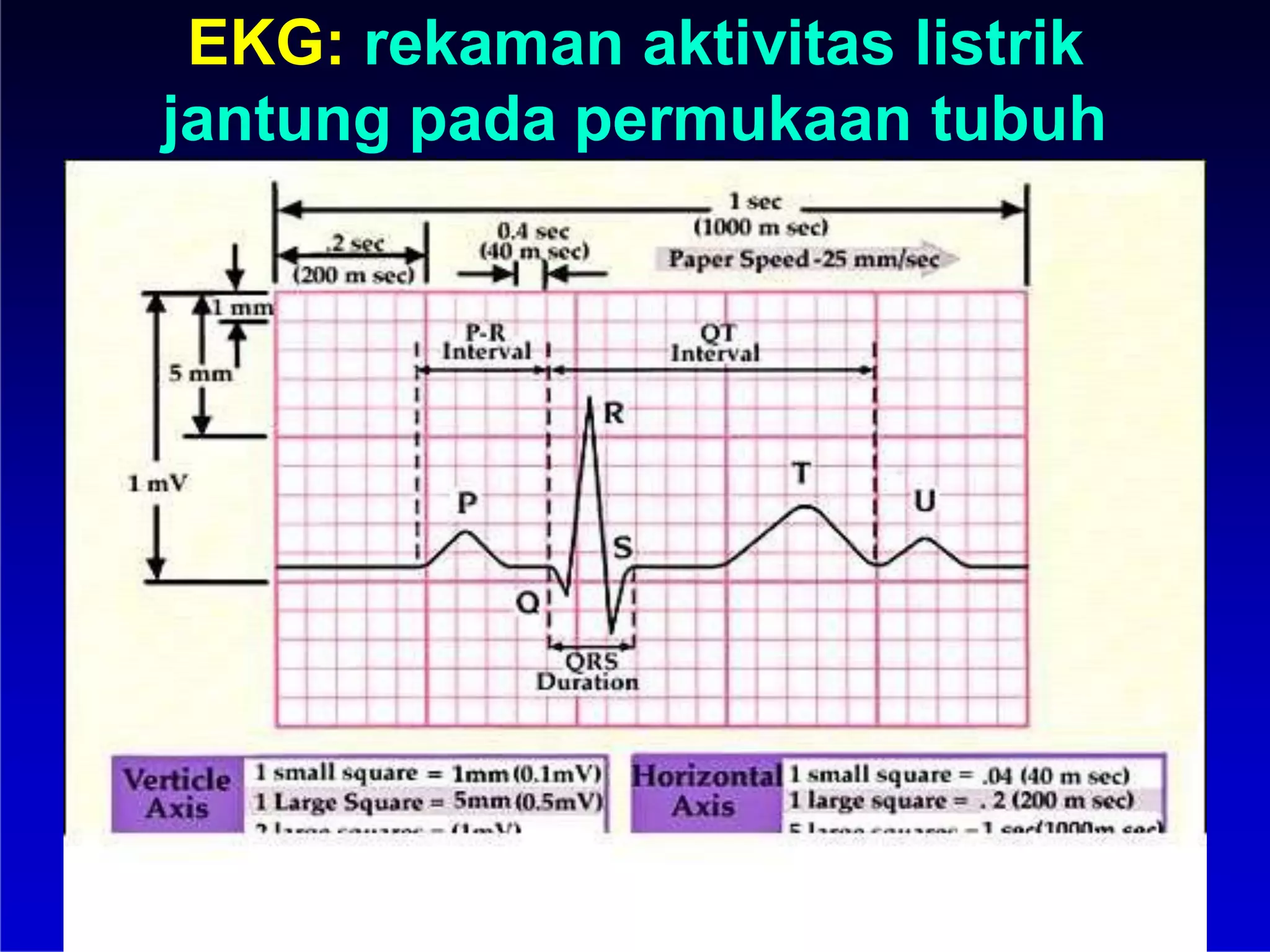 Modul Cara Praktis Membaca EKG.pdf